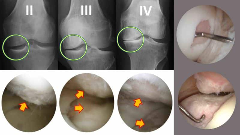 Anatomia do Joelho - Clínica do Joelho