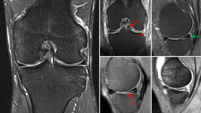 Anatomia do Joelho - Clínica do Joelho