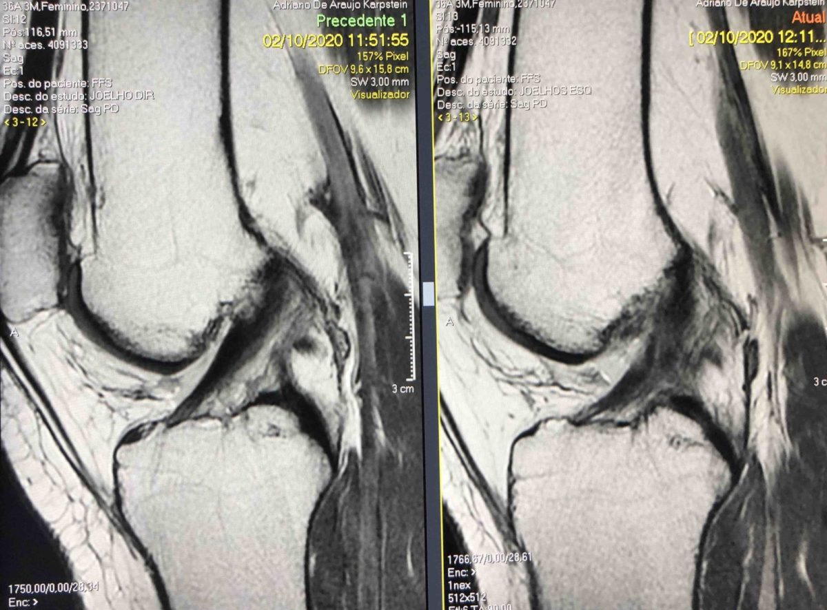 Anatomia do Joelho - Clínica do Joelho