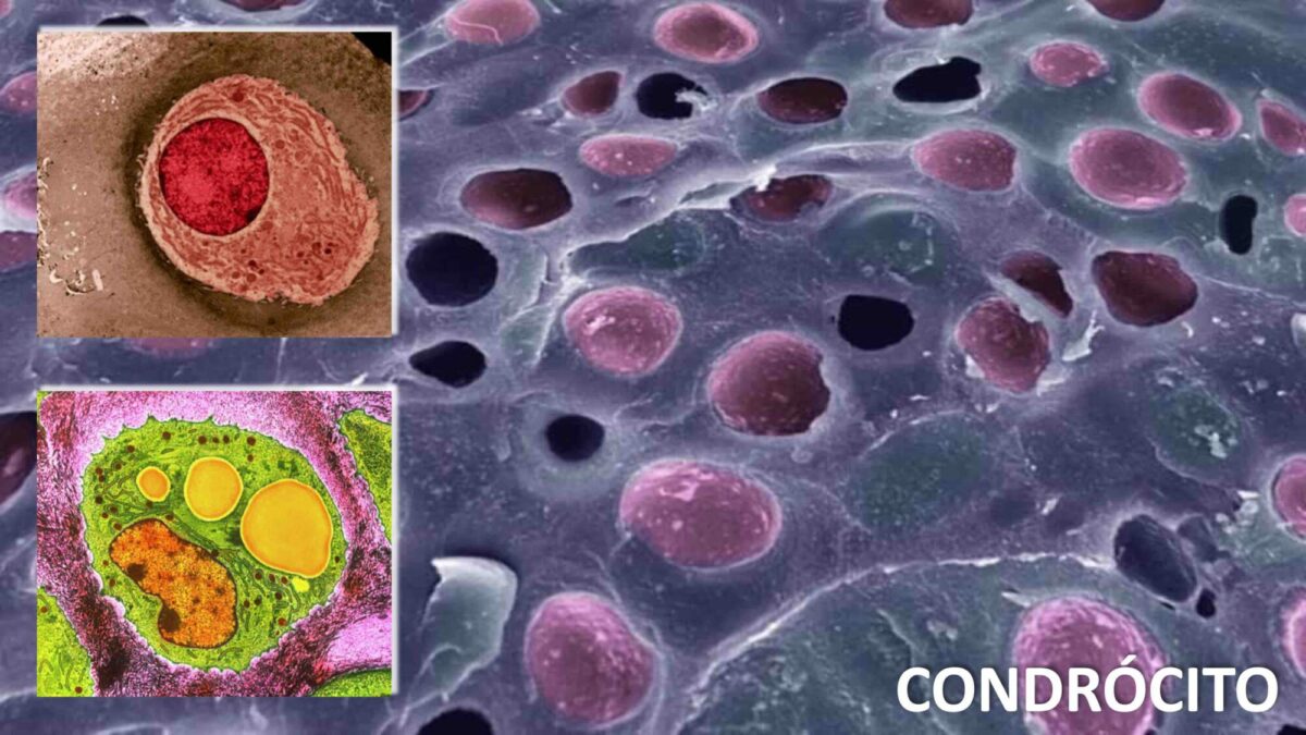 Cartilagem do Joelho - Clínica do Joelho
