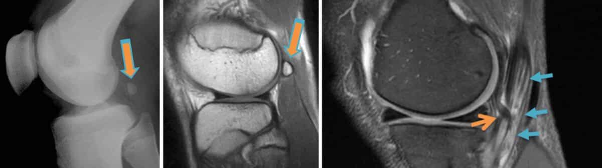 Fabela - Clínica do Joelho