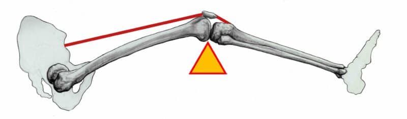 Patela - Clínica do Joelho