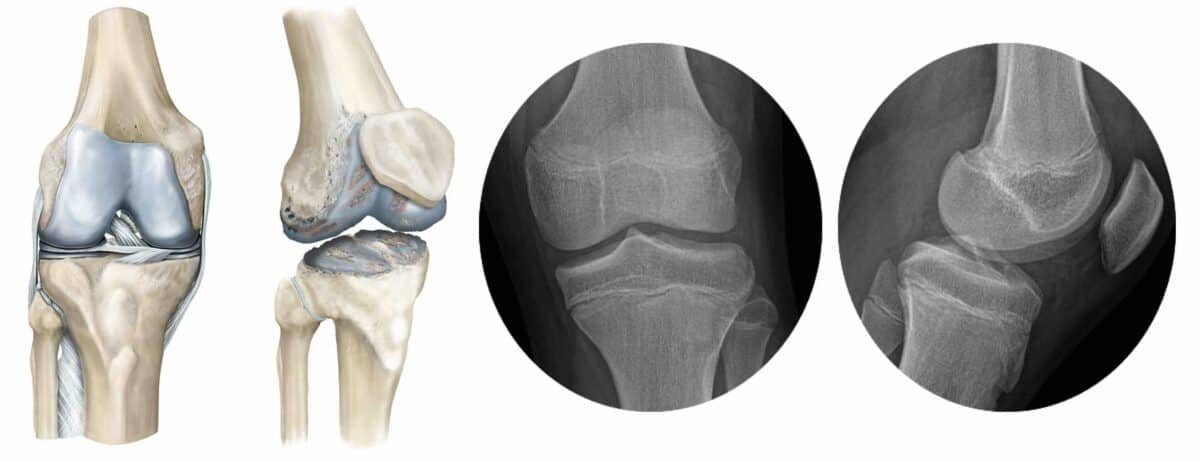 Joelho normal - Clínica do Joelho