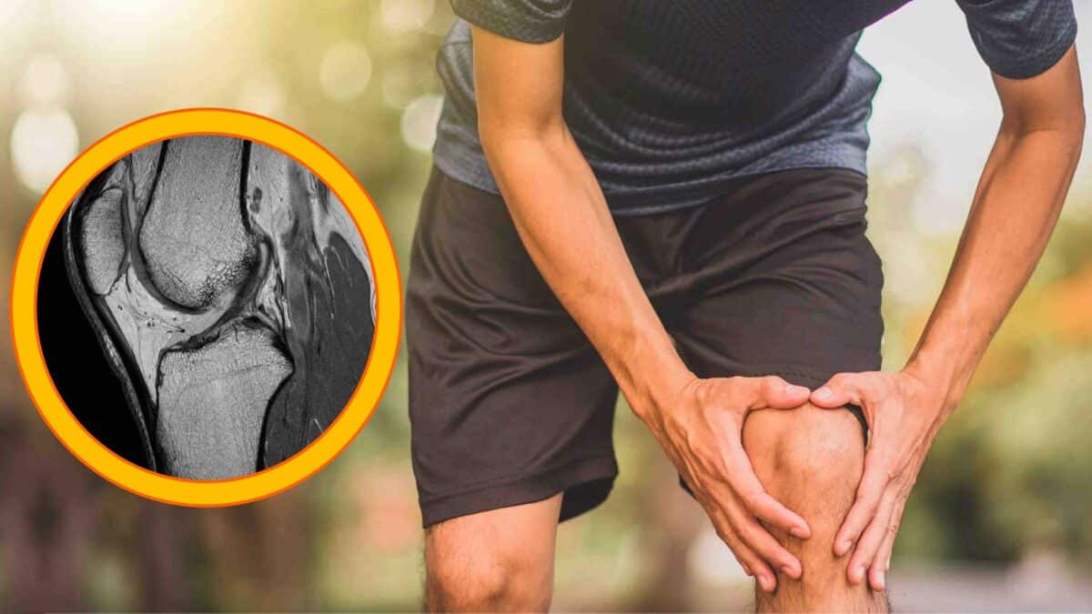 Tendão do Joelho - Clínica do Joelho