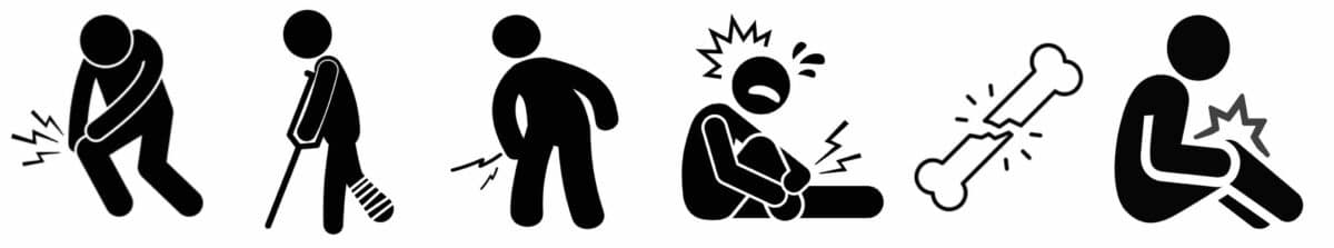 Contusão, entorse, luxação e fratura - Clínica do Joelho