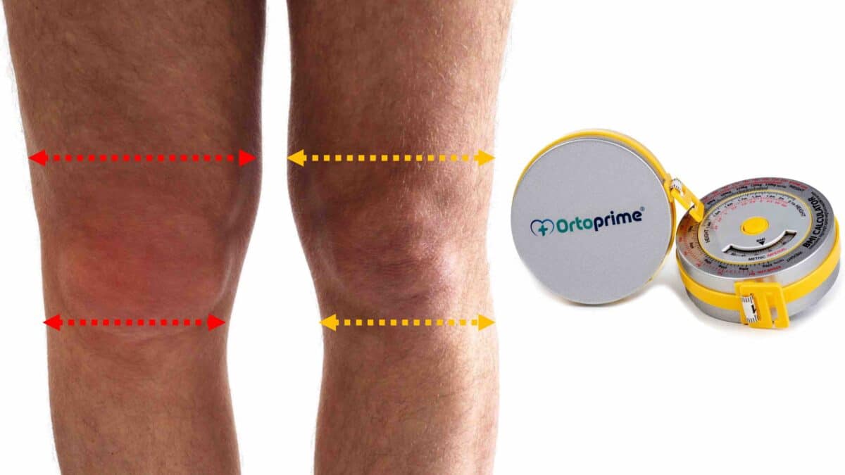 Perimetria do Joelho - Clínica do Joelho