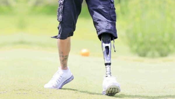 Amputação na região do Joelho - Clínica do Joelho