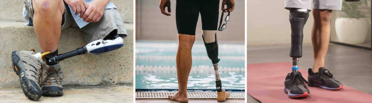Amputação na região do Joelho - Clínica do Joelho